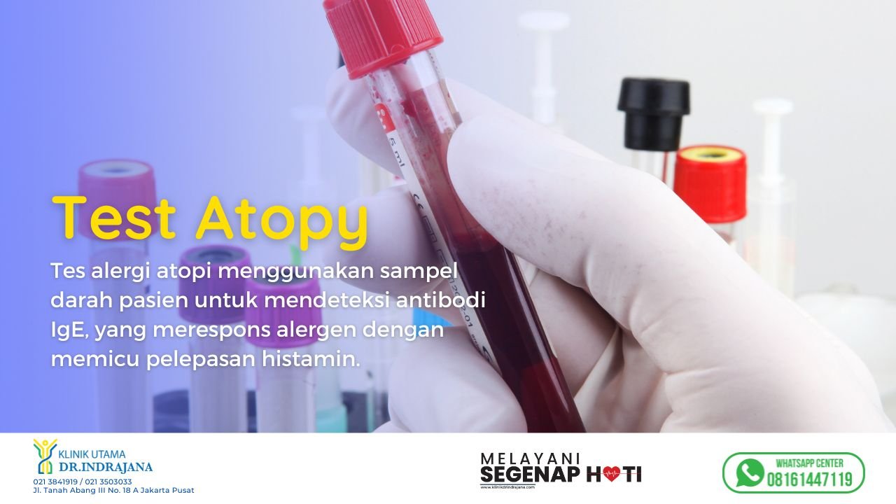 tes alergi atopy - Klinik Utama DR Indrajana